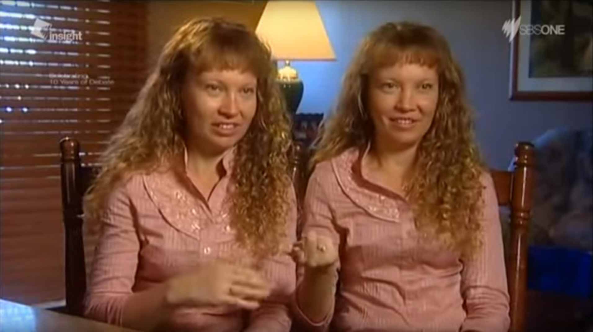 Two Of A Kind Twins Who Are Truly And Fully Identical